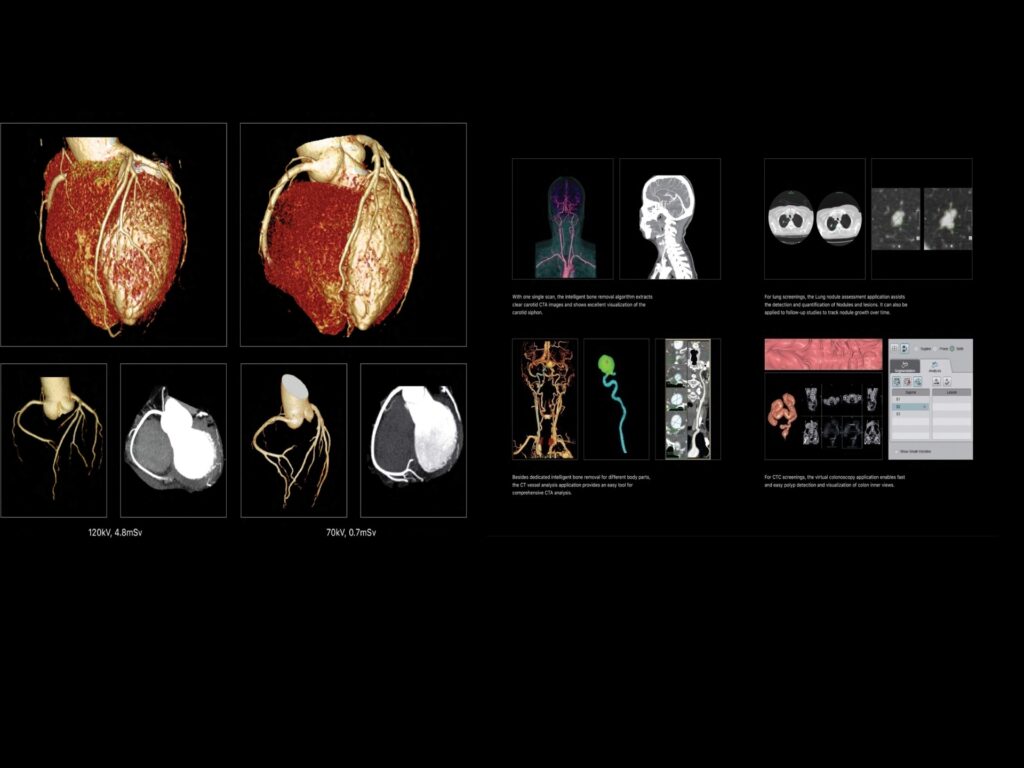 Ultrafast Multislice Ct Scan – GIC Prime